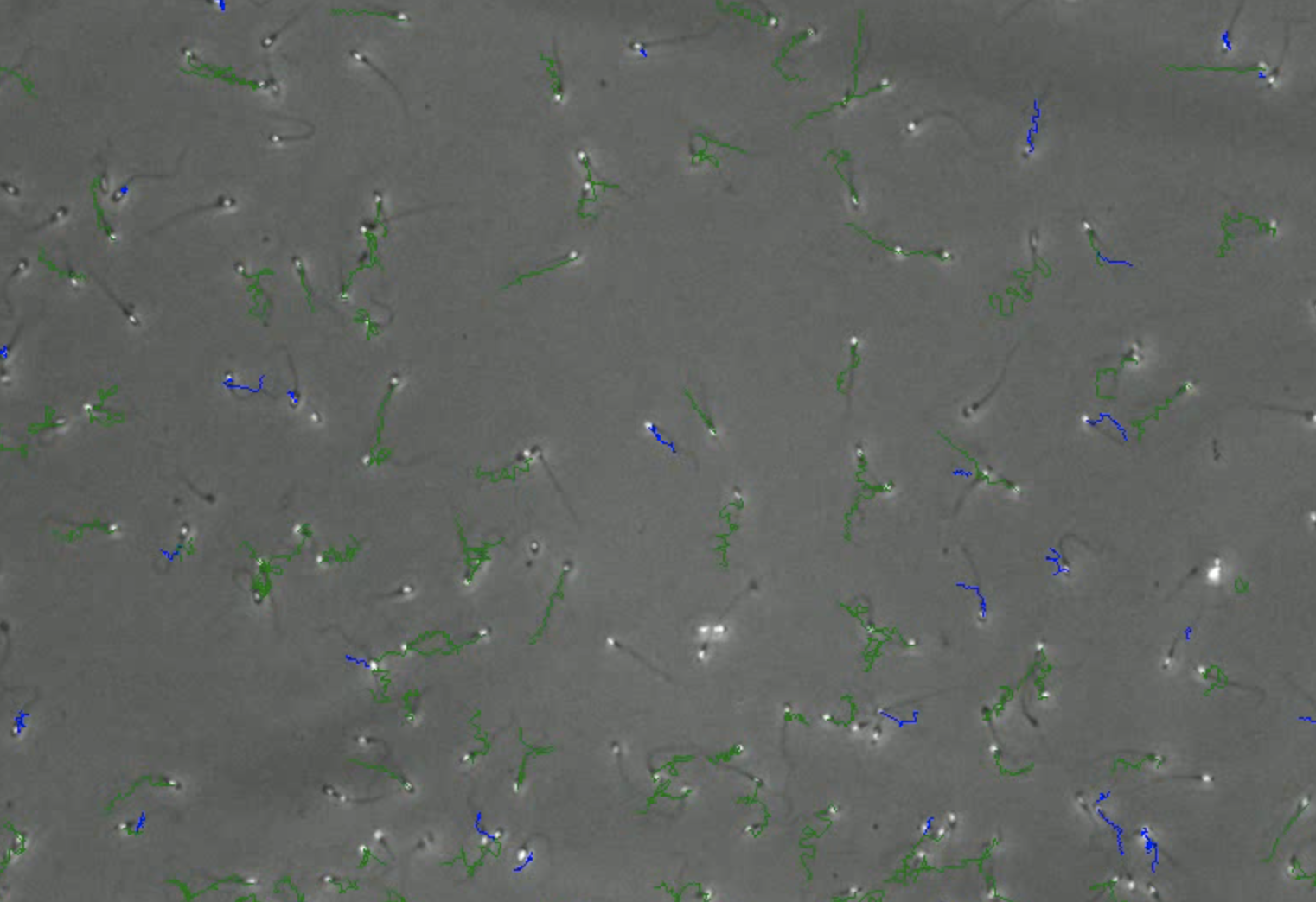 Boost Fertility Success with the Zymot Method at Hospital Plodnost ...