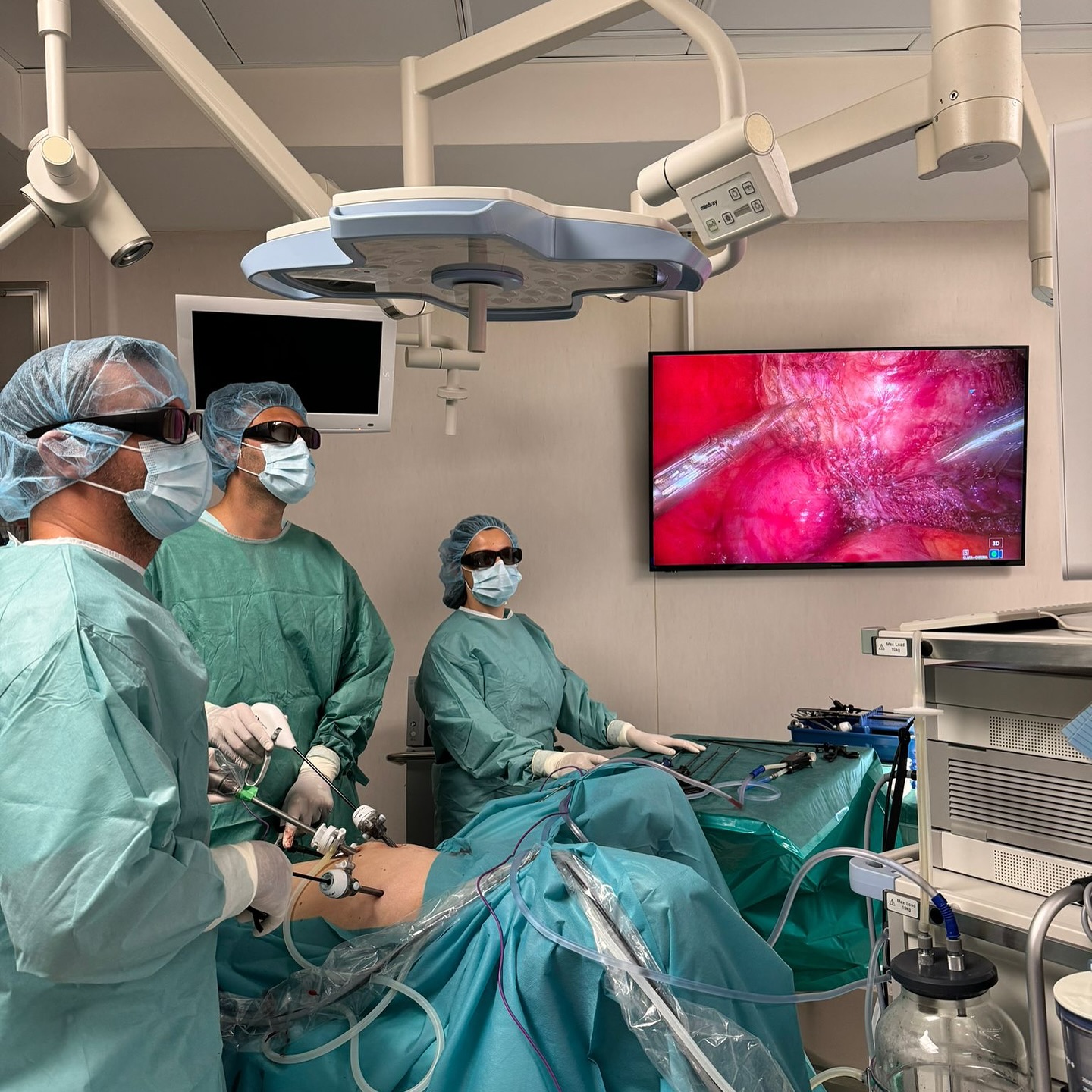 Successfully performed Myomectomy on deep intramural myom - Hospital ...